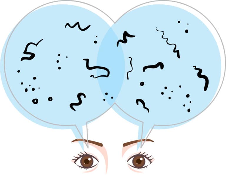 Flashing Lights in Eye: Top Causes & When to See a Doctor
